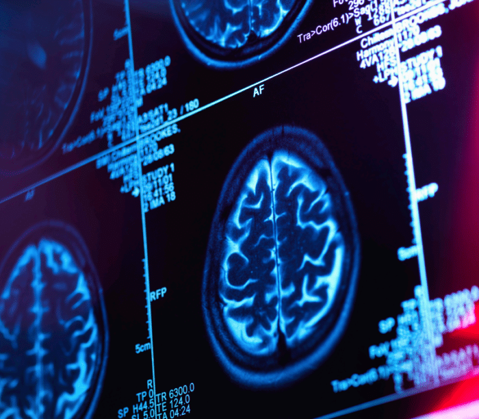 PE - Vector Medical Group